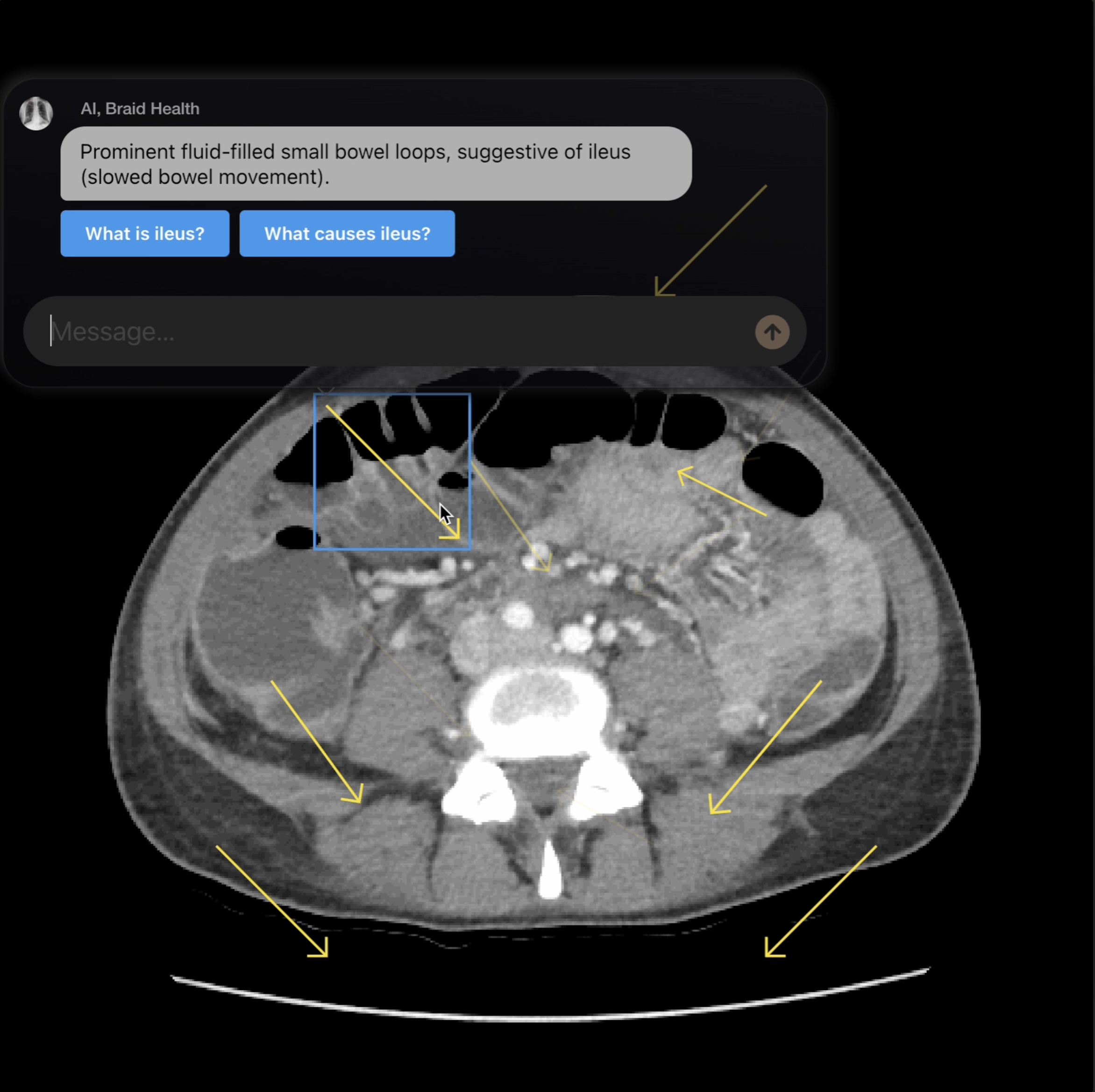 Braid Health - Ask AI - Take Charge of Your Imaging, Anywhere
